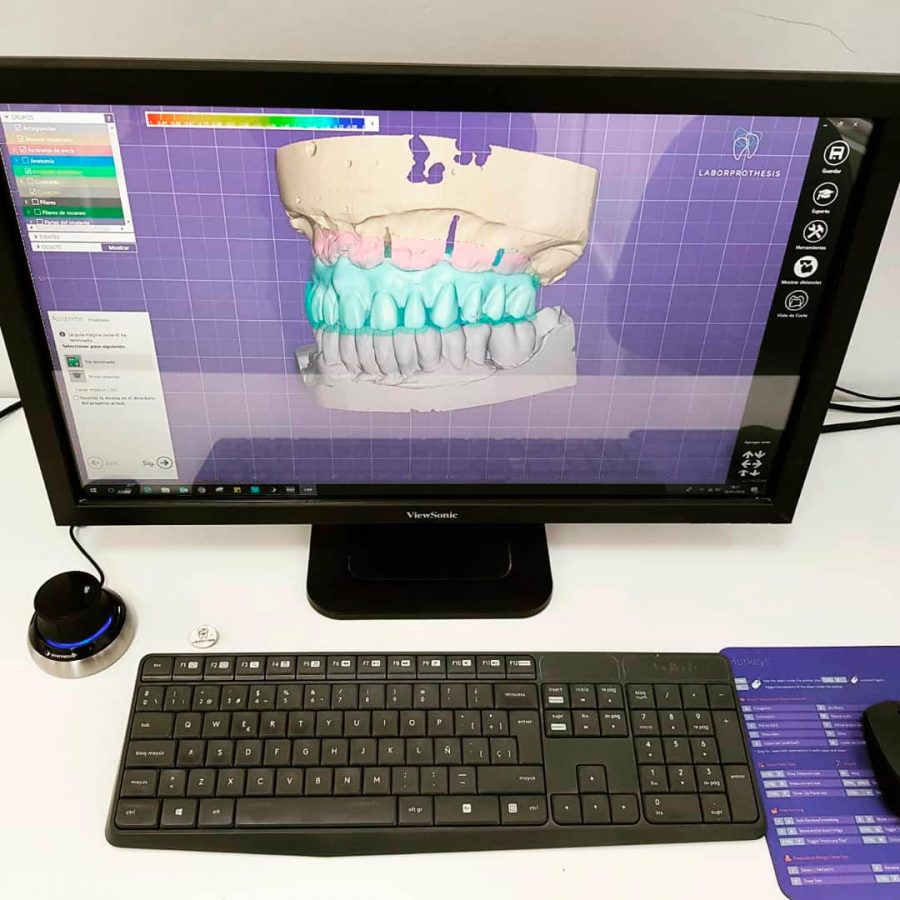 Laboratorio Dental CAD CAM | Laborprothesis